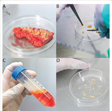 How To Properly Preserve Human Tissue Samples? - Meditate for good health
